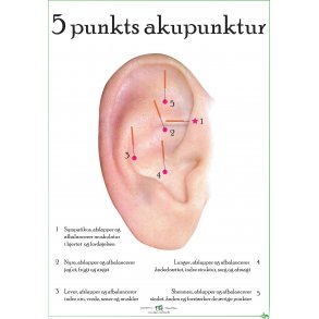 akupunktur nåle m.m.